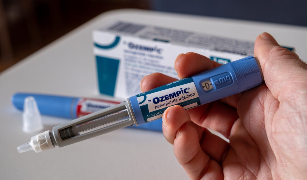 Underskatta inte värdet av viktminskning